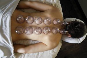 Cupping massage What to expect Resolution Health